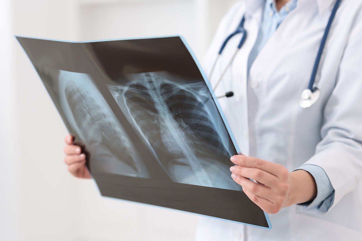 X-Ray - Associates In Family Practice
